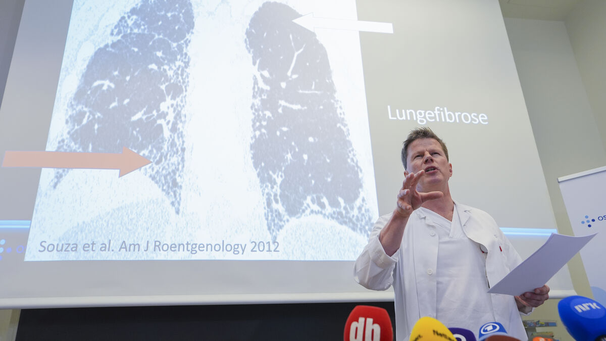 Mette-Marit has received new lungs - Here's how it works | Sweden Herald