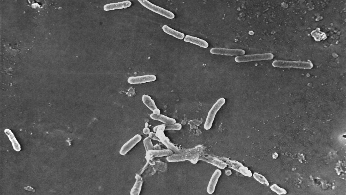 Antibiotic-Resistant Bacteria Infections Surge Globally, Warns WHO ...