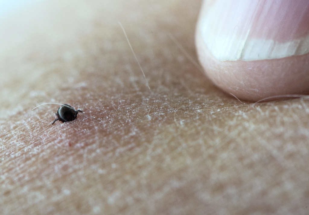 New tick-borne infection found in blood donors | Sweden Herald