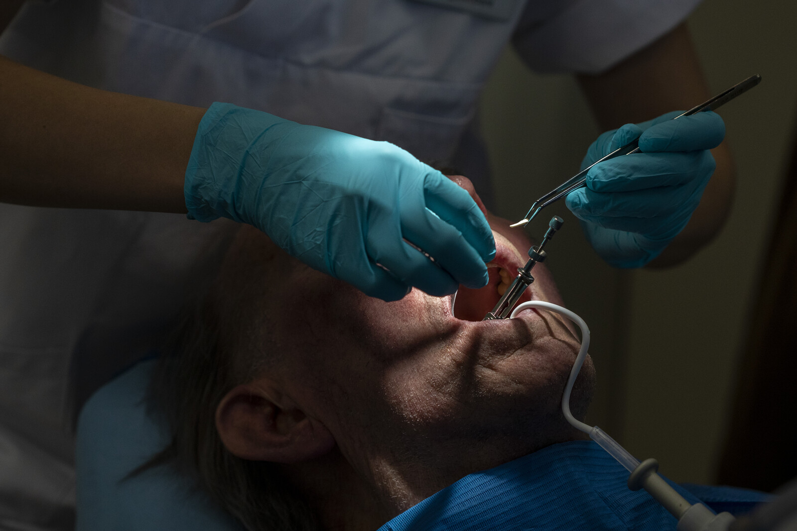 Pulled out too many teeth – loses license | Sweden Herald