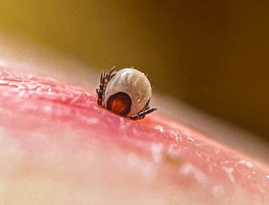 Deadly tick may become more common in Sweden | Sweden Herald
